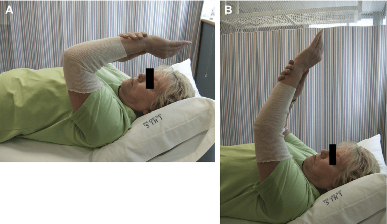 Elbow instability - Avanthi Mandaleson