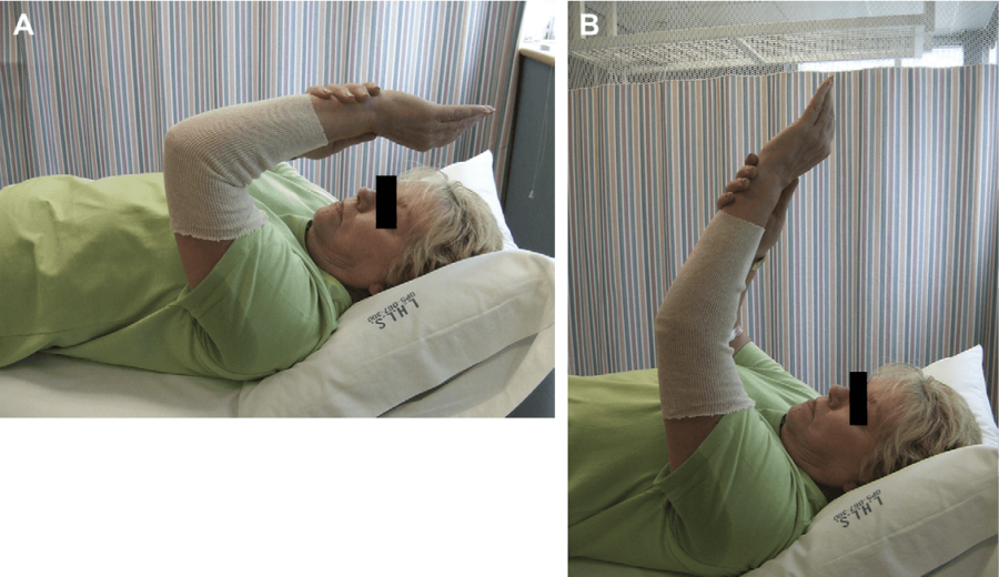 Elbow instability - Avanthi Mandaleson