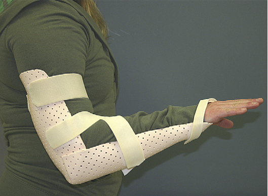 Posterior Elbow Splint